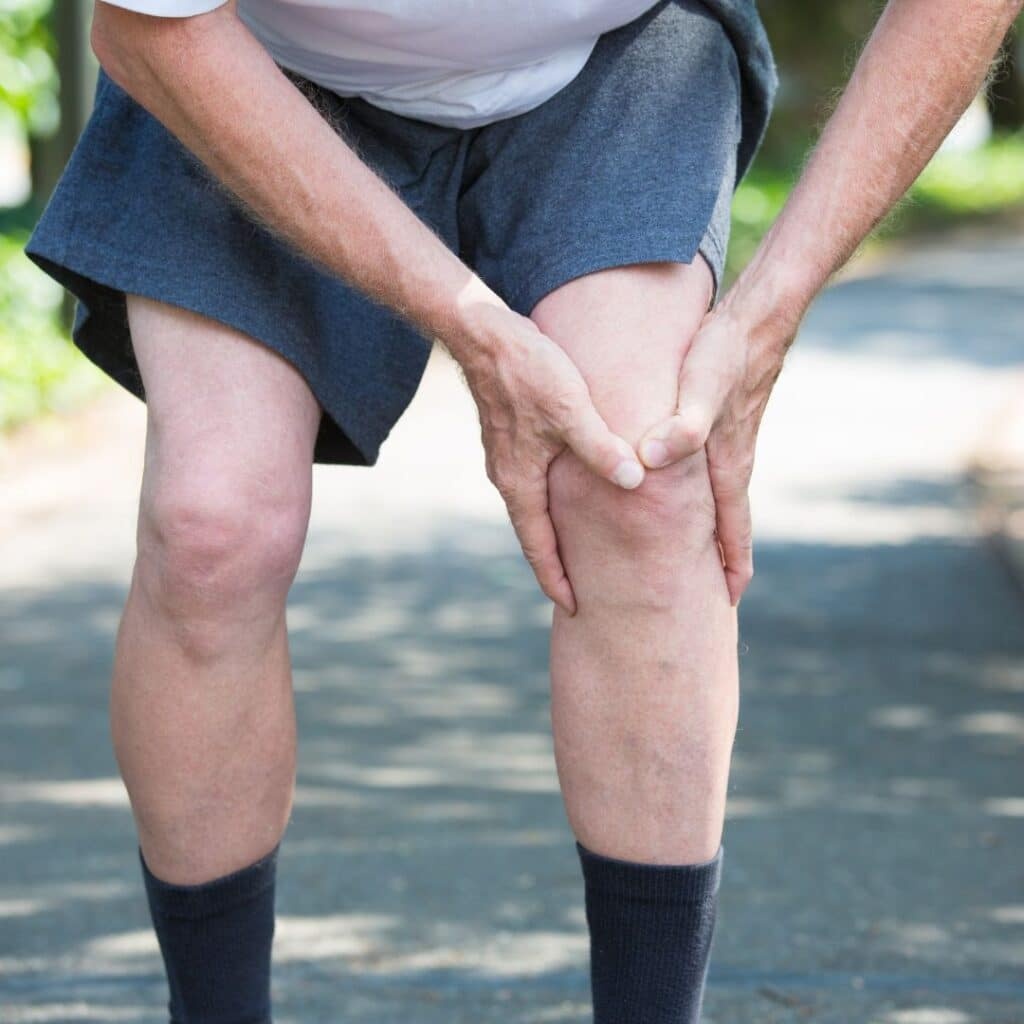 Can You Exercise with a Bone Bruise? RxFit's Guide & Tips